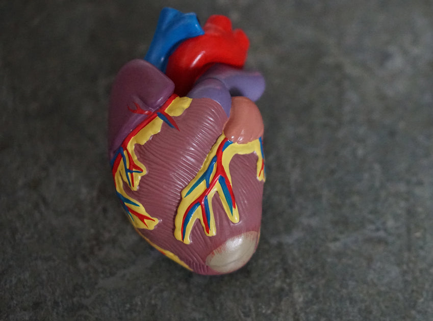 What is a Coronary Calcium Scan? | LAIIC – LA Imaging & Interventional ...